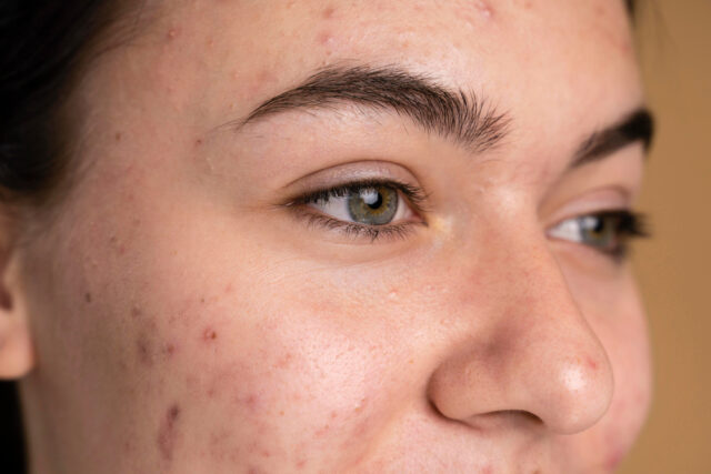 6 Ways Estrogen Levels Affect Your Skin—And What To Do About It
